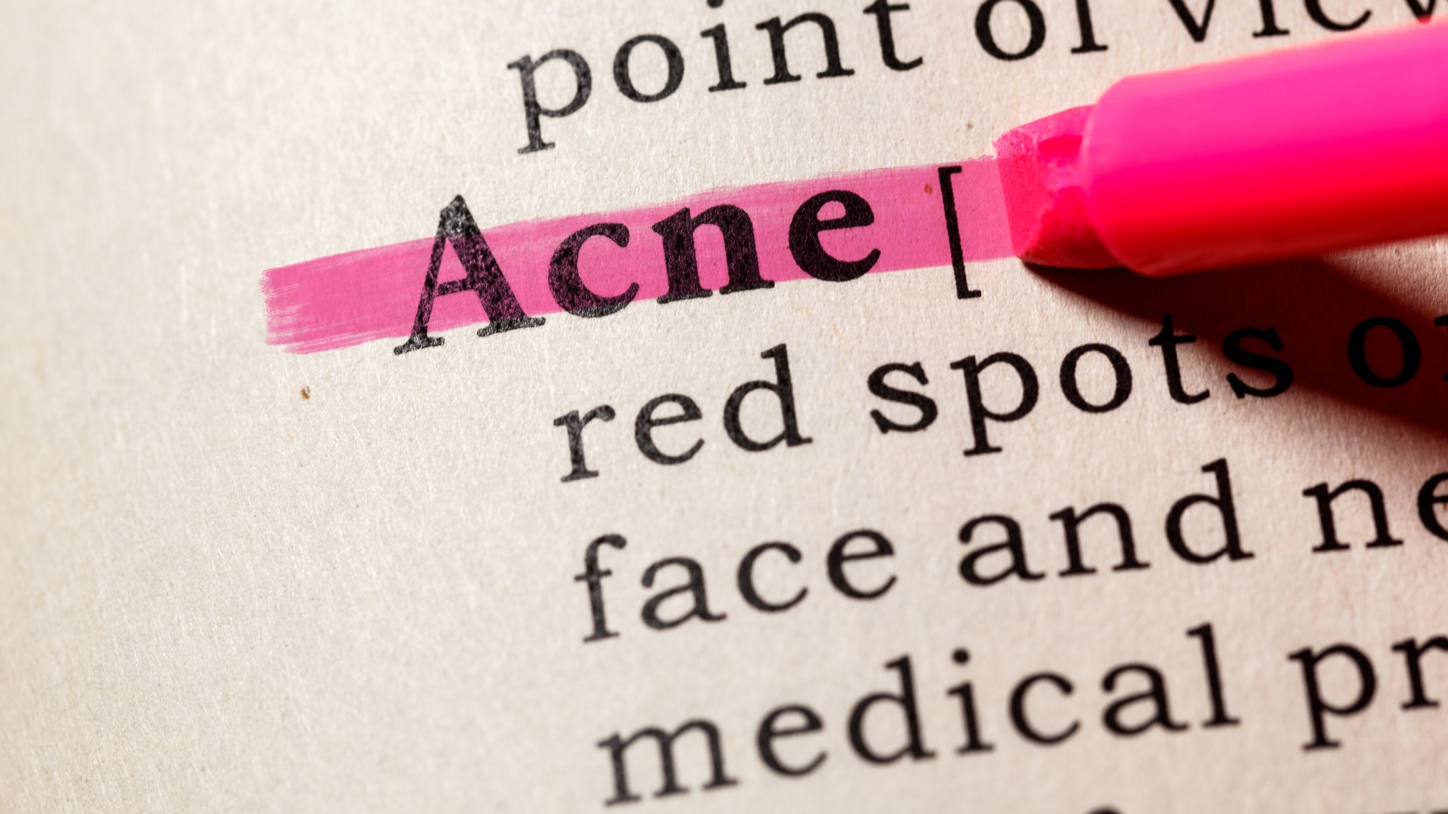 Can Cystic Acne Be Cured? – Ahaa® Skincare